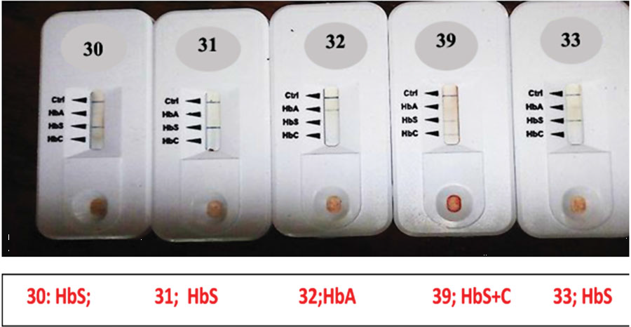 SICKLE CELL DISORDER: IMPORTANCE OF SELF-CARE (PART TWO) - The Sickle ...